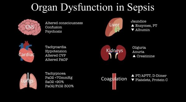 What Truly Defines Organ Dysfunction Due To Sepsis Sepsis Program